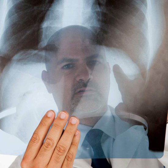 Diagnostic Radiology – X-ray - North Broward Radiologists