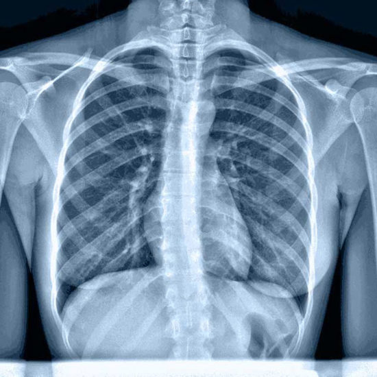 Chest / Cardiovascular Imaging - North Broward Radiologists